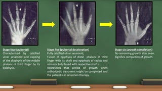 Skeletal Age Assessment and Maturity Indicators | PPTX