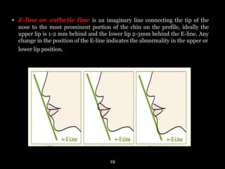 Smile analysis and digital smile design | PPTX
