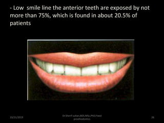 Smile analysis and digital smile design | PPTX