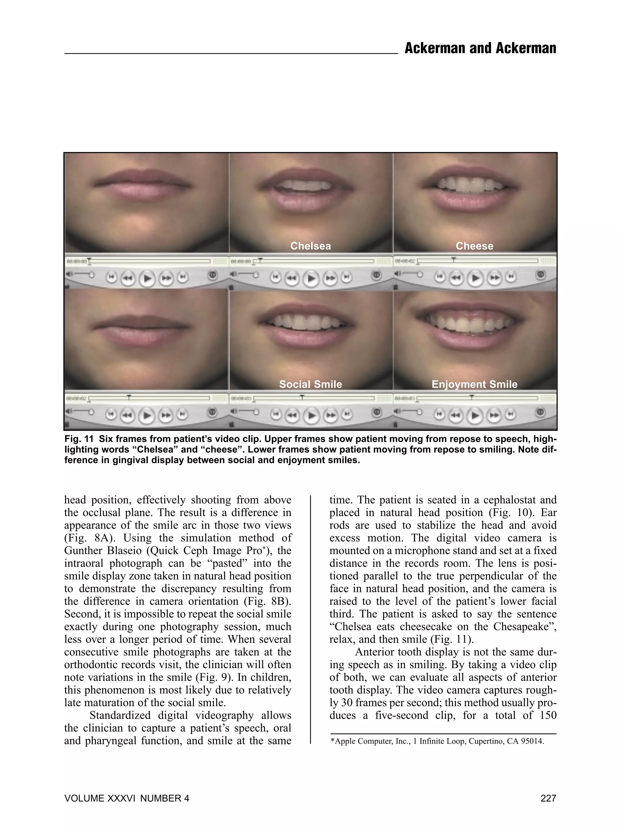 Smile analysis digital era | PDF