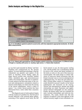 Smile analysis digital era | PDF
