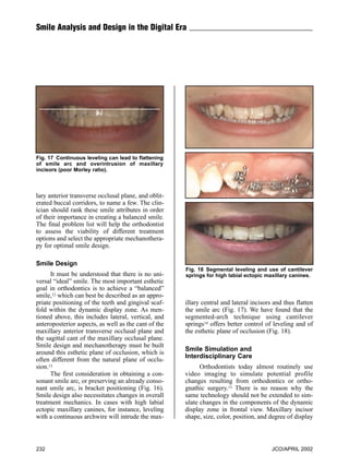 Smile analysis digital era | PDF