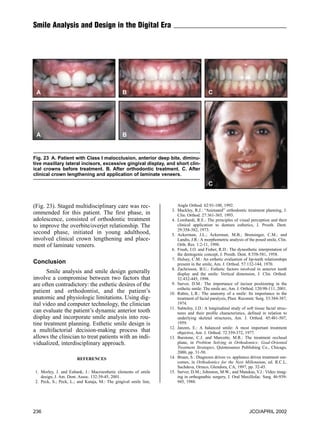Smile analysis digital era | PDF