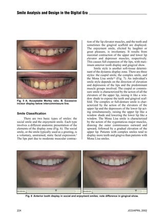 Smile analysis digital era | PDF