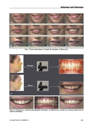 Smile analysis digital era | PDF