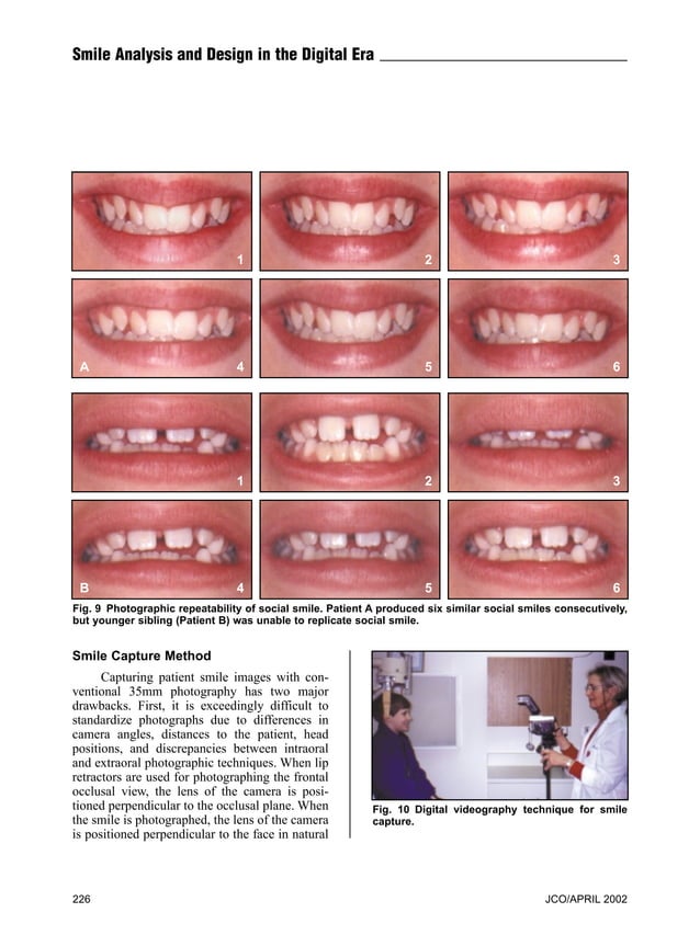 Smile analysis digital era | PDF