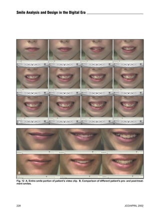 Smile analysis digital era | PDF