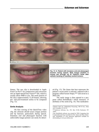 Smile analysis digital era | PDF