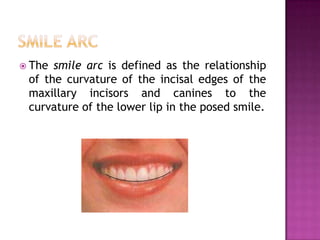 Smile analysis in vertical dimention:- factors to be considered when ...