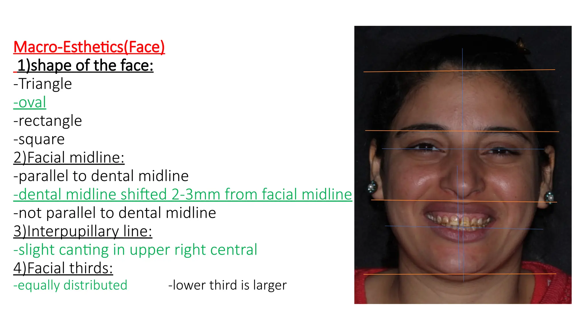 smile analysis noura.pptxfwafwasfwasfasfaf | PPTX