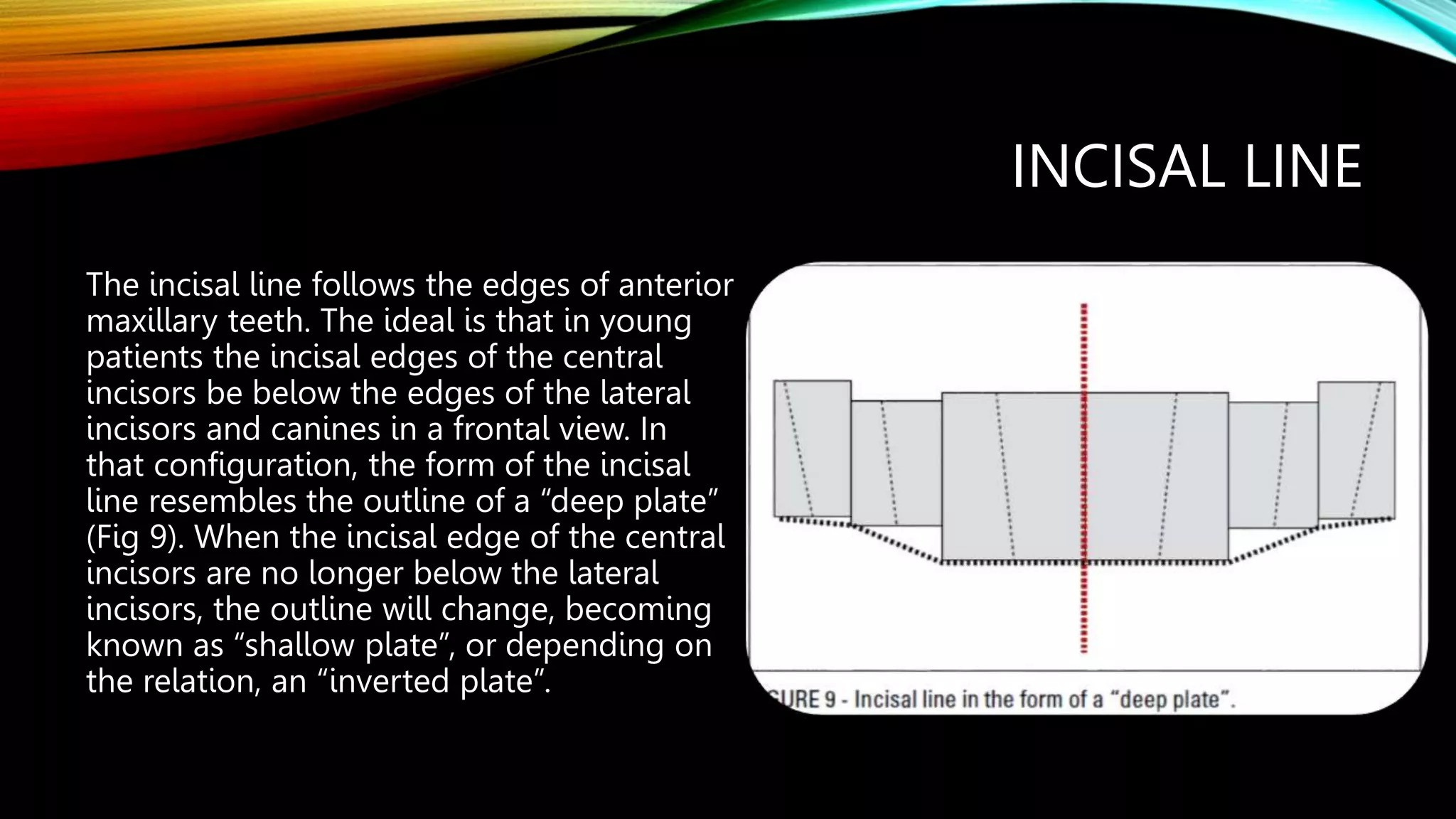 Smile Arc Positioning.pptx
