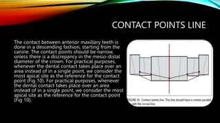 Smile Arc Positioning.pptx