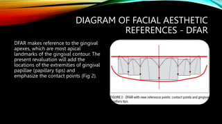 Smile Arc Positioning.pptx
