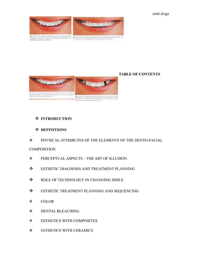 Smile design | PDF