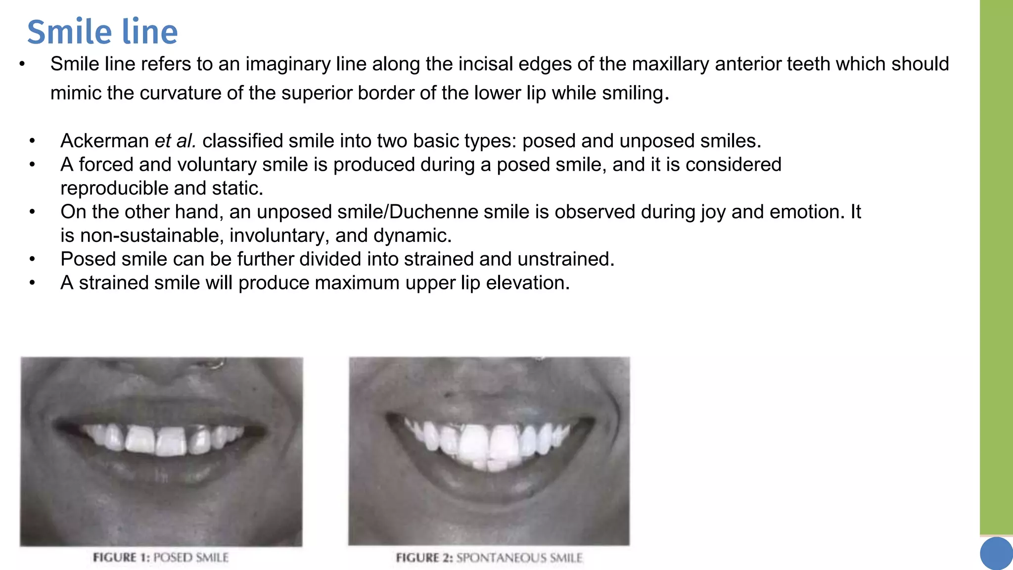 smile design | PPTX