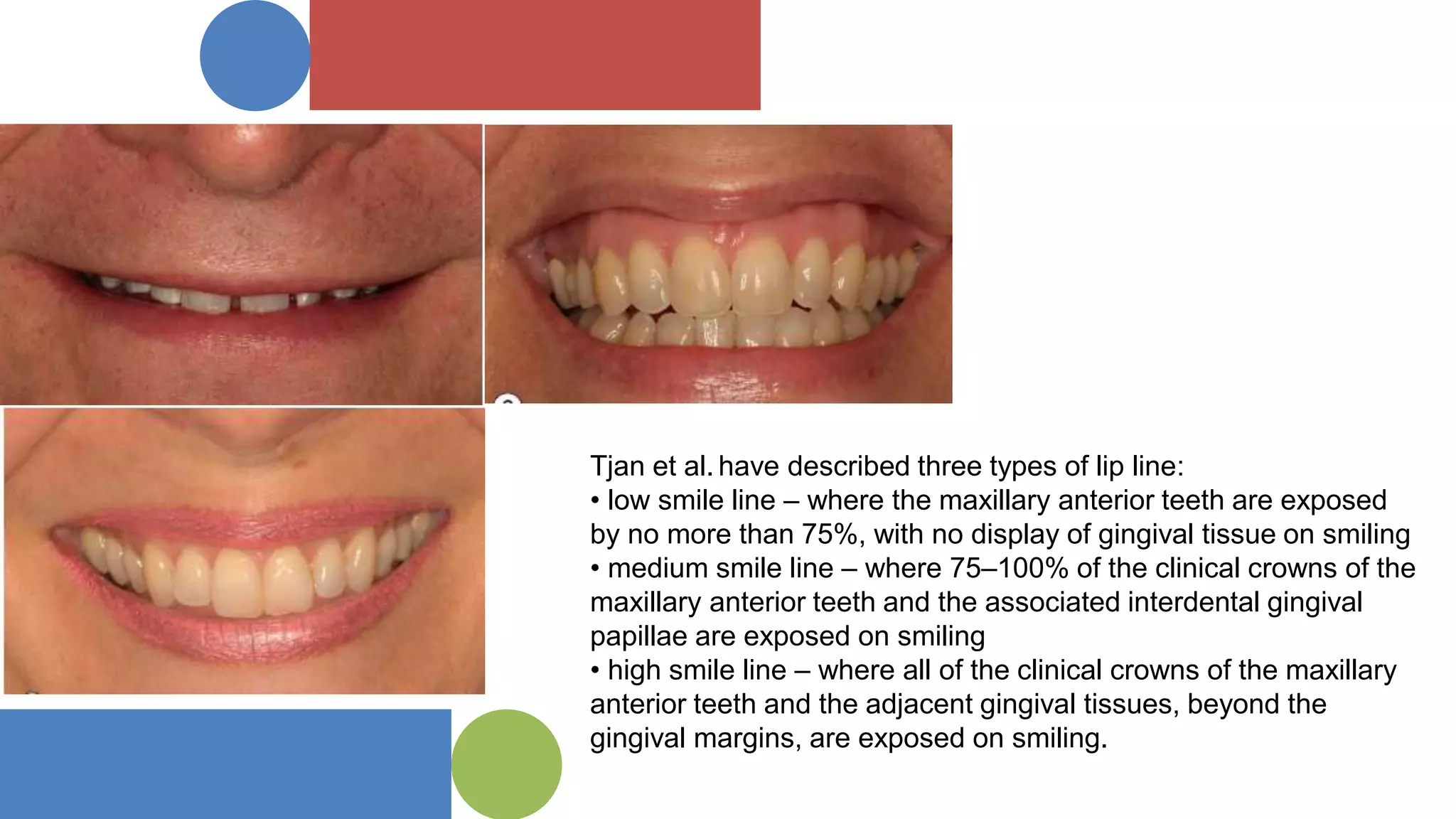 smile design | PPTX