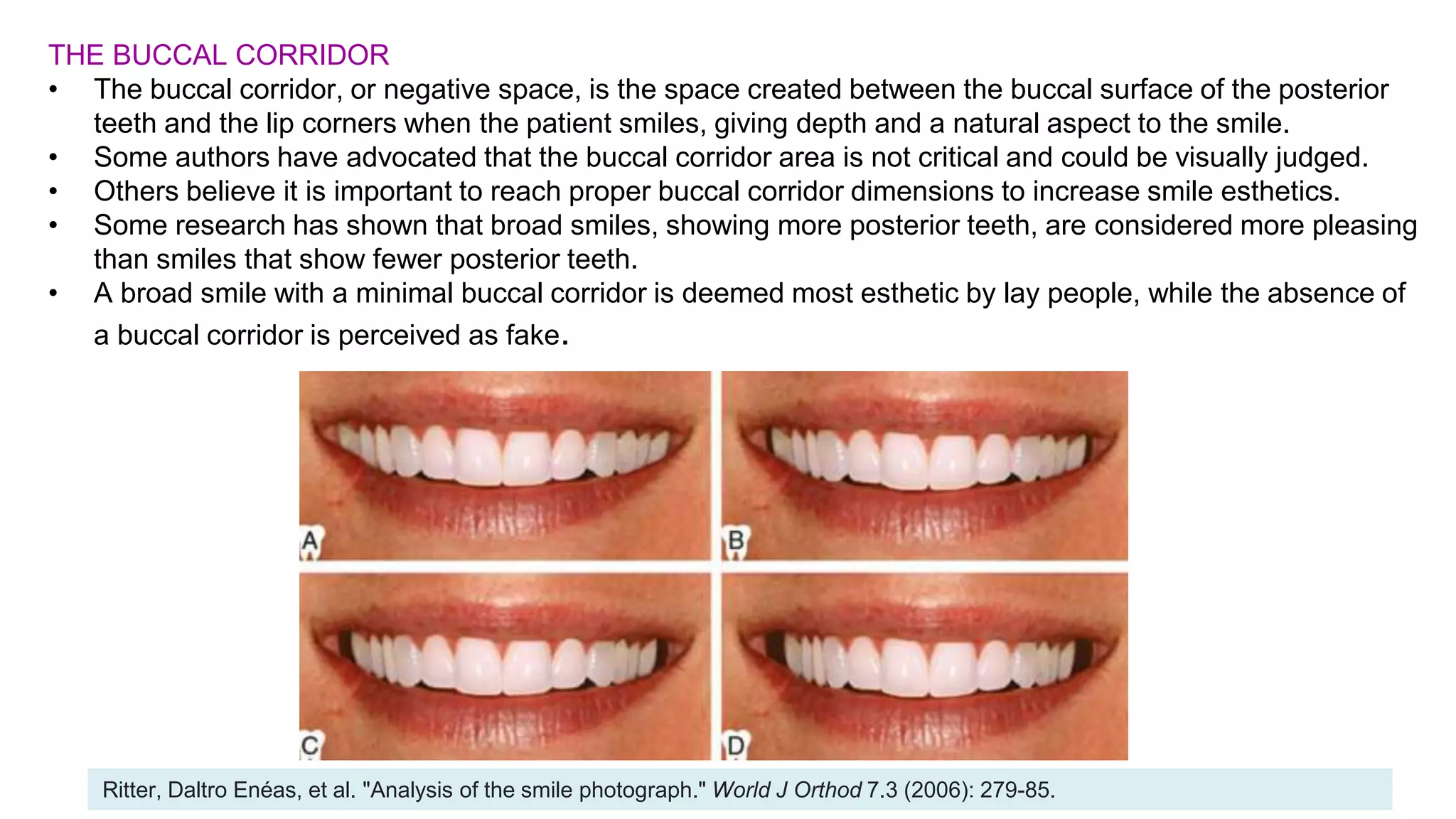 smile design | PPTX