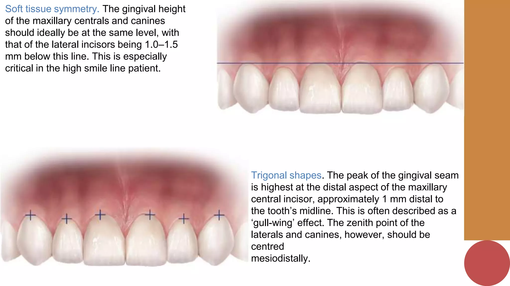 smile design | PPTX