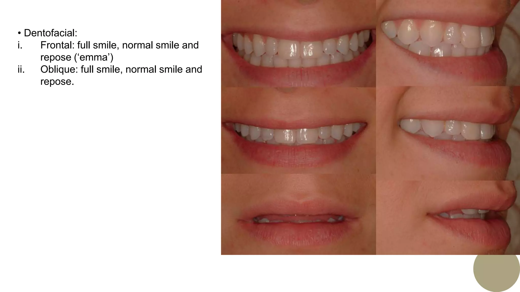 smile design | PPTX