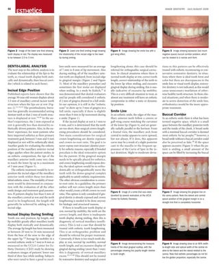 Smile design 09 | PDF