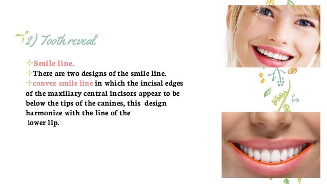 Smile design dental edutainment_student at faculty of dentistry ahram…