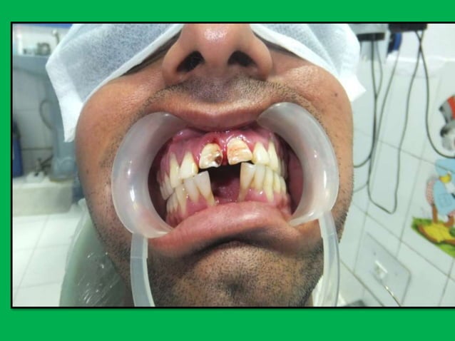 Thind Dental Clinic | PPT