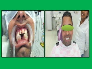 Thind Dental Clinic | PPT