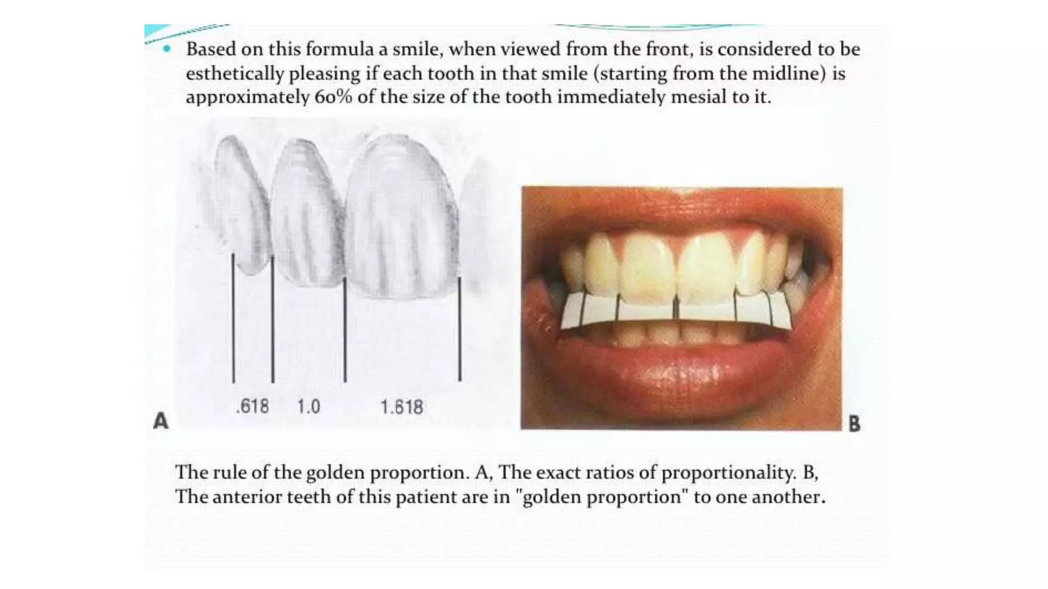 SMILE DESIGNING sem 1.pptx