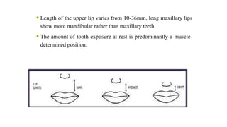 SMILE DESIGNING sem 1.pptx