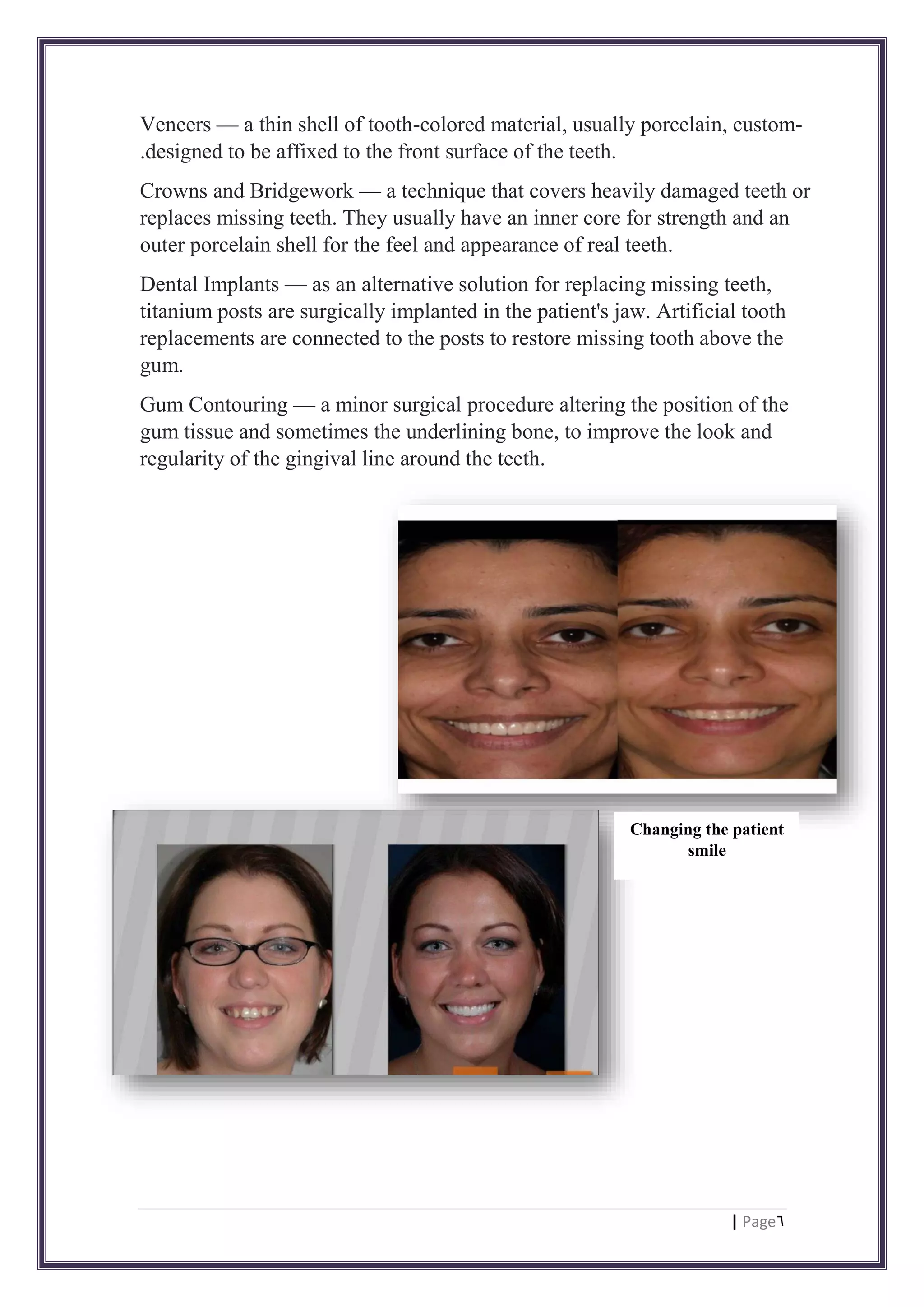 Smile design (operative dentistry ) | PDF