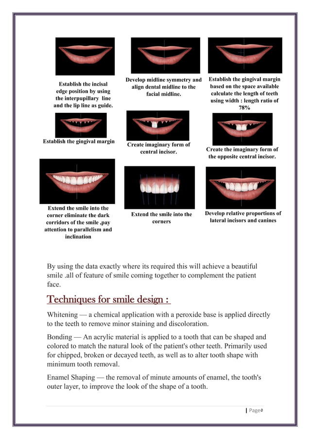 Smile design (operative dentistry ) | PDF