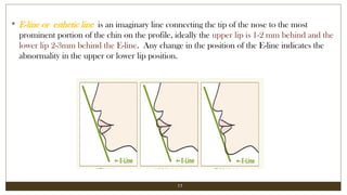 Basics in digital smile designing procedure | PPTX