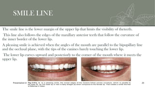 Basics in digital smile designing procedure | PPTX