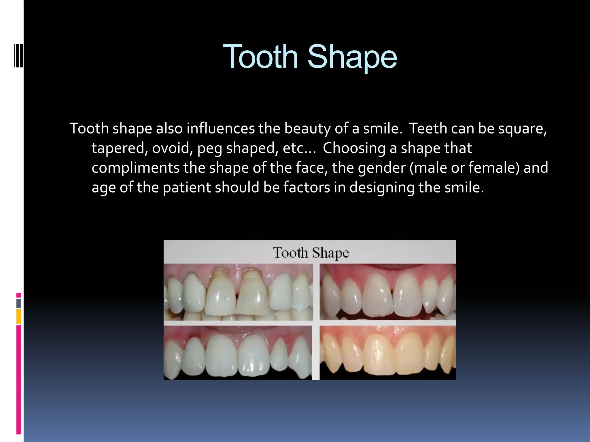 Smile design principles for patients from boudetdds.com