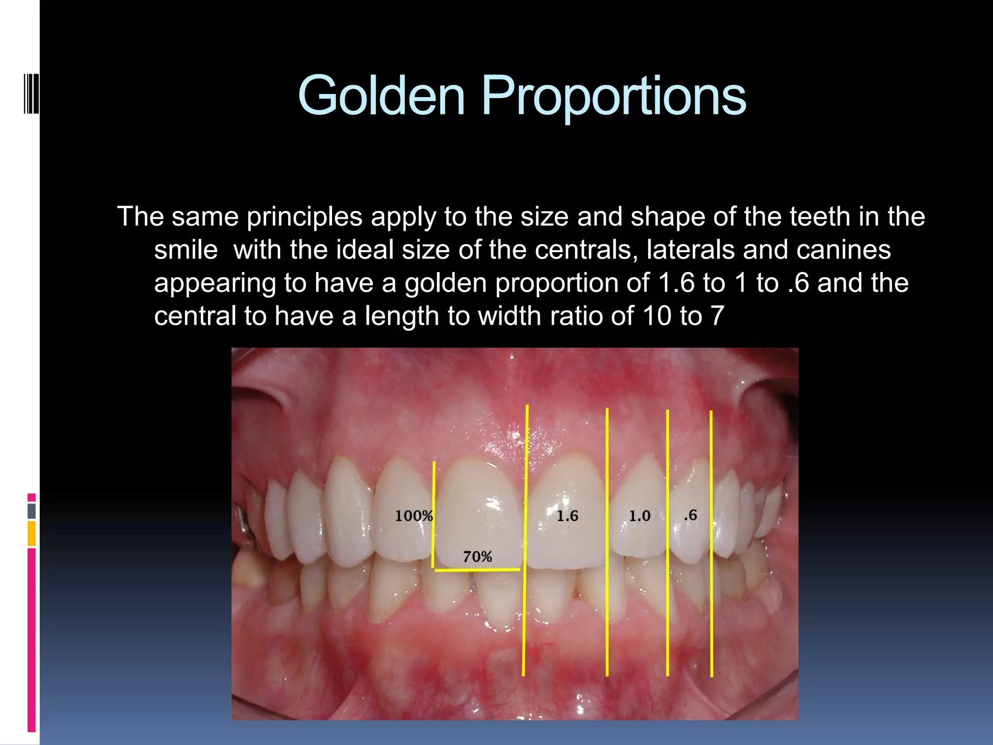 Smile design principles for patients from boudetdds.com