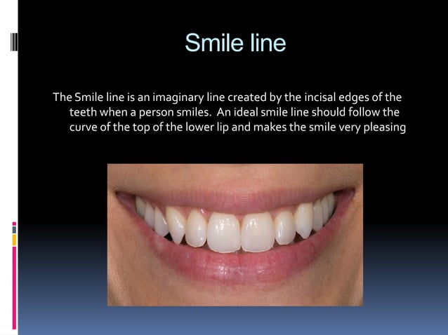Smile design principles for patients from boudetdds.com | Dental Health ...