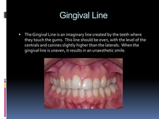 Smile design principles for patients from boudetdds.com