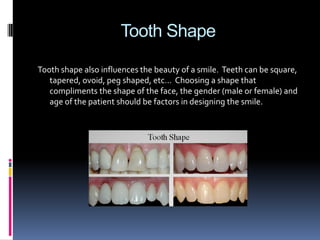 Smile design principles for patients from boudetdds.com