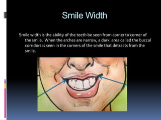 Smile design principles for patients from boudetdds.com
