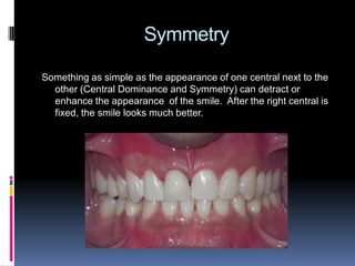 Smile design principles for patients from boudetdds.com