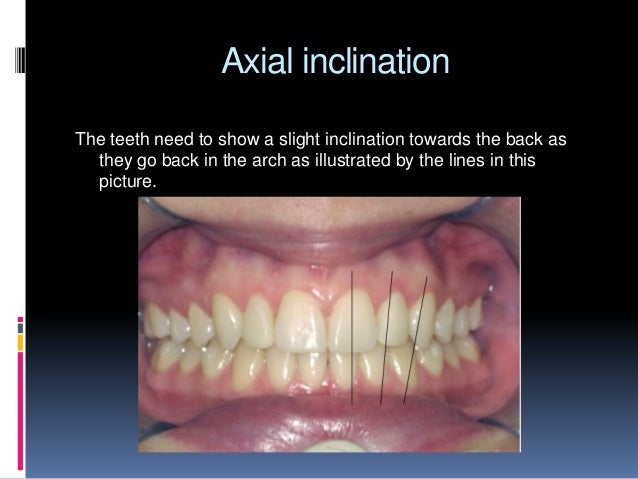 Smile design principles for patients from boudetdds.com