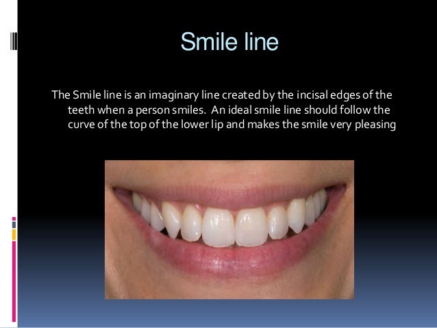 Smile design principles for patients from boudetdds.com