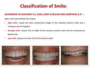 Smile design semenar | PPT