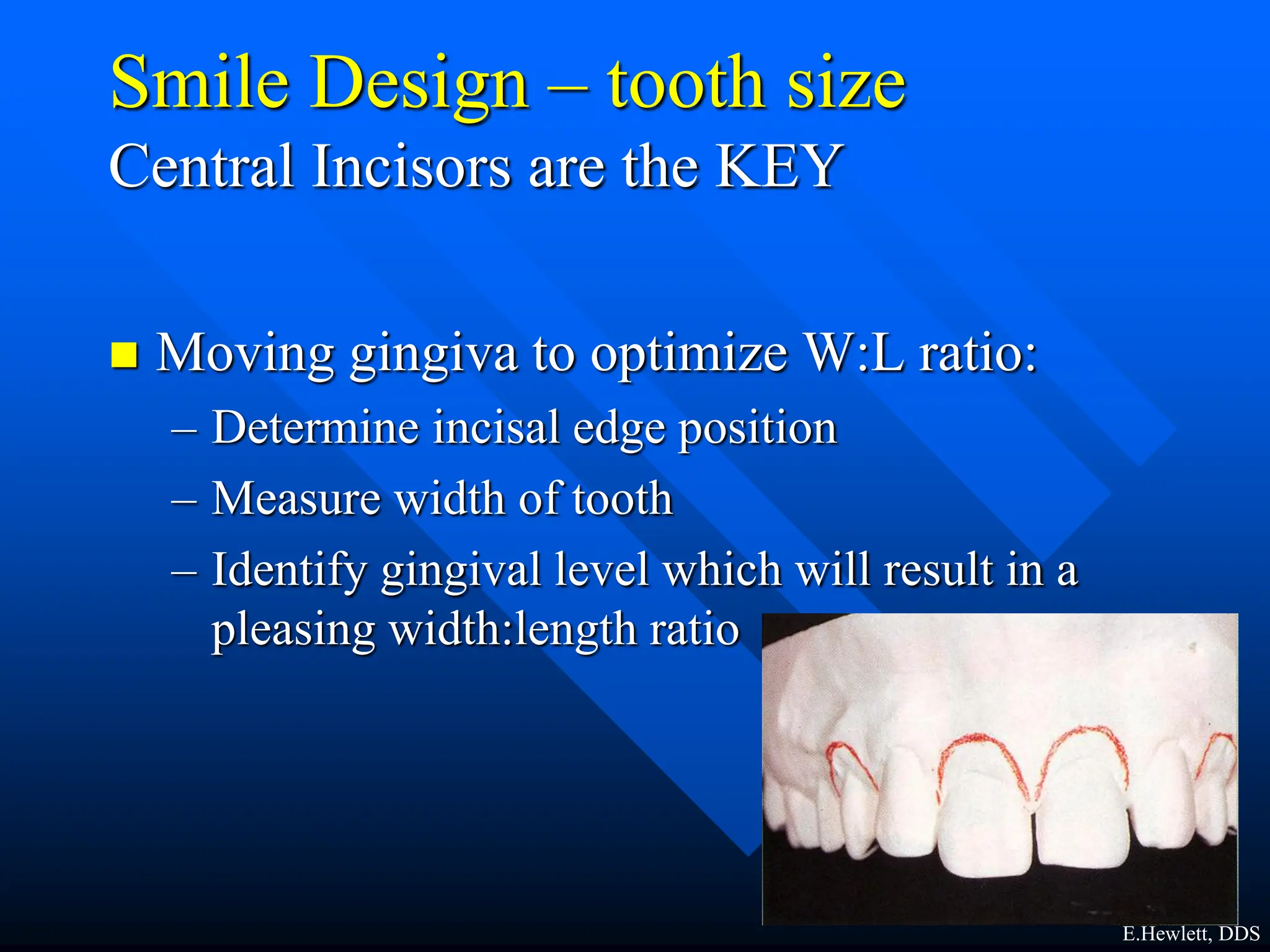 Smile Designs II, things to consider .pdf