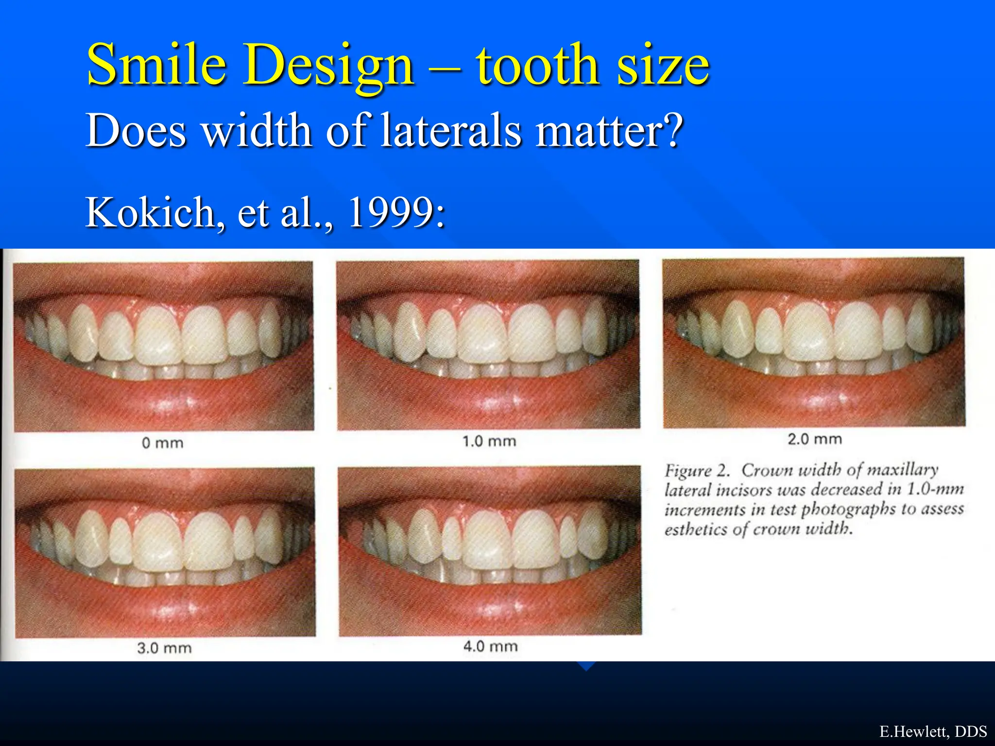 Smile Designs II, things to consider .pdf