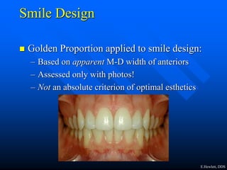 Smile Designs II, things to consider .pdf