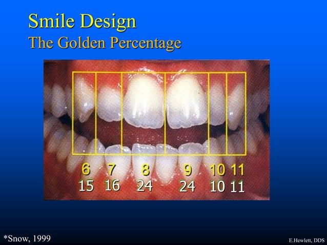 Smile Designs II, things to consider .pdf