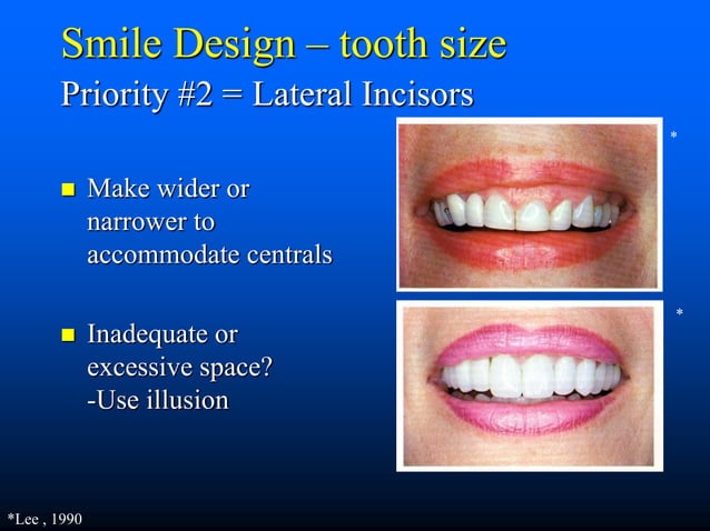 Smile Designs II, things to consider .pdf
