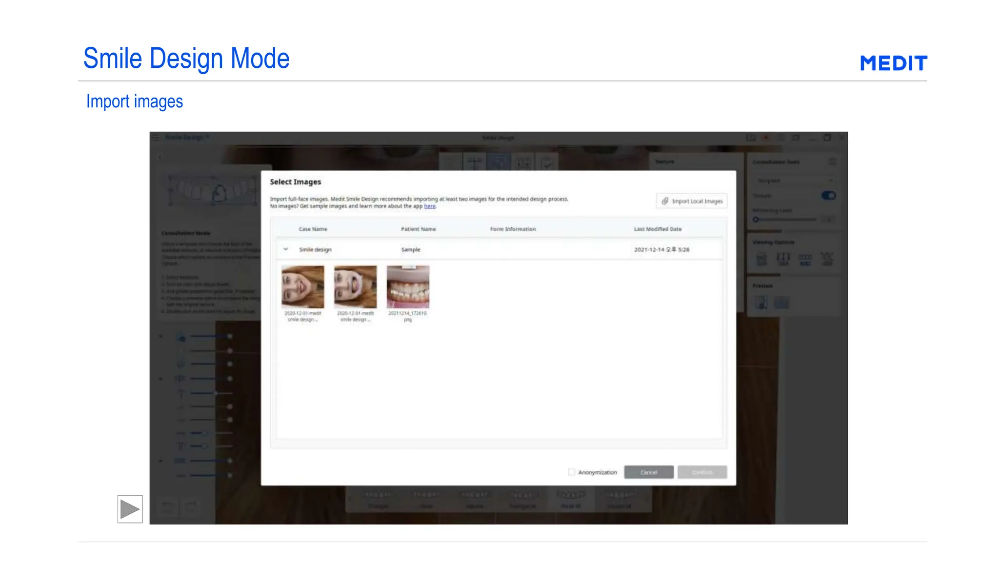 Smile Design in CAD Software User Manual.pptx