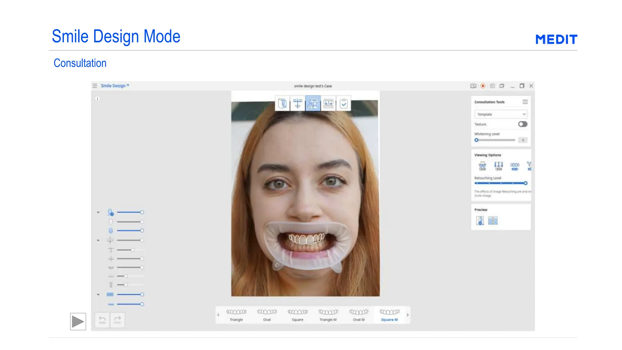 Smile Design in CAD Software User Manual.pptx